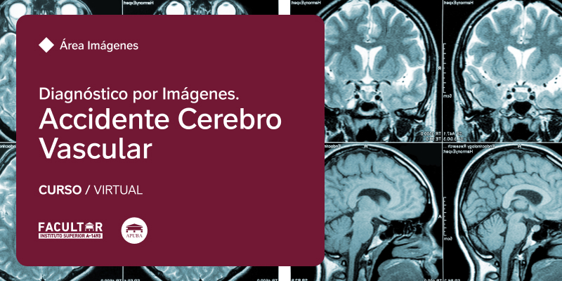 Anatomía Cerebral Vascular ANATOMÍA VASCULAR DEL CEREBRO.